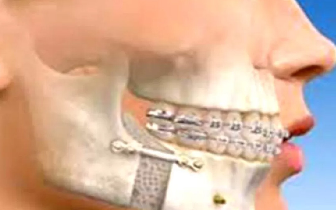 Best Maxillofacial Surgery in South Extension: Your Go-To Solution for ...